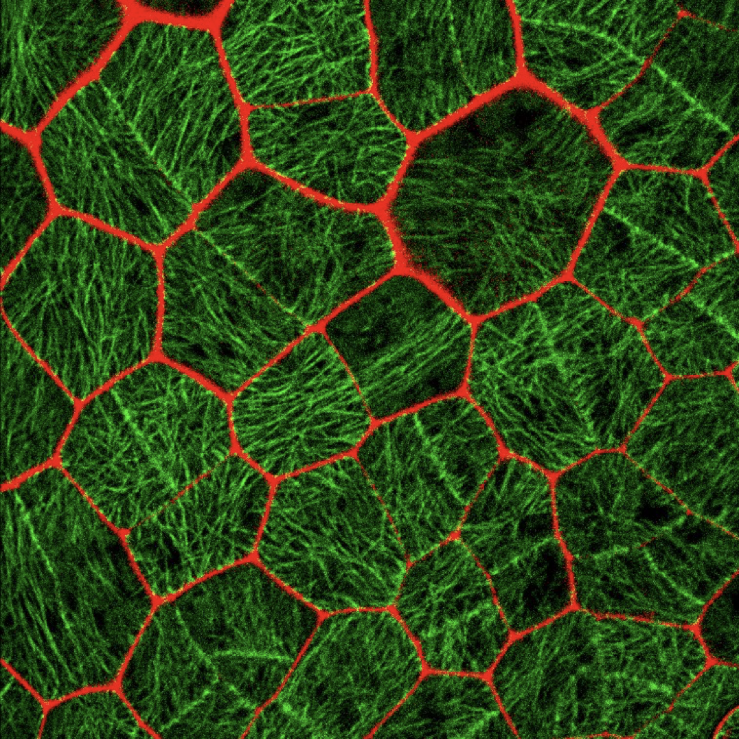 Define Microtubule In A Plant Cell at Kathy Foley blog